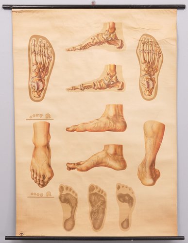 Vintage Pull-Down Medical Wall Chart Illustrating Orthopedics of Foot ...