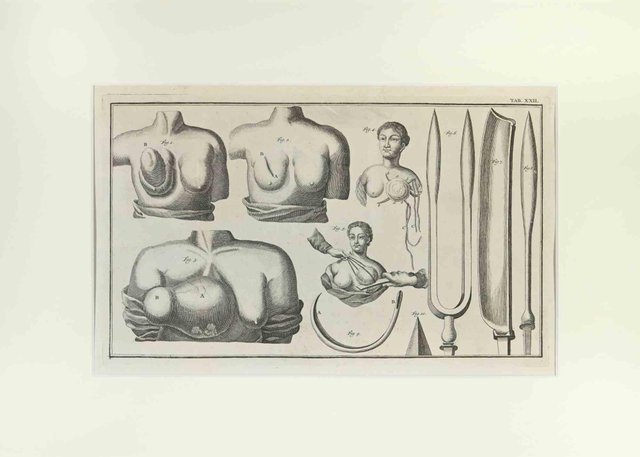 Lorenz Heister, Surgical Instruments, Etching, 1750 for sale at Pamono