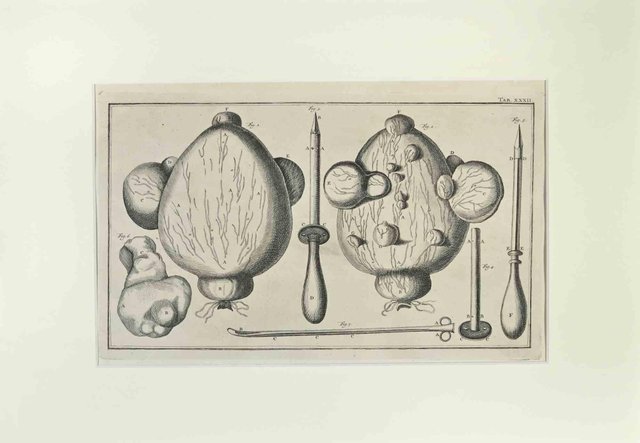 Lorenz Heister, Surgical Instruments, Etching, 1750 for sale at Pamono