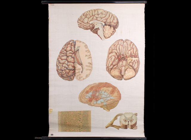 Vintage German Brain Poster, 1960s for sale at Pamono
