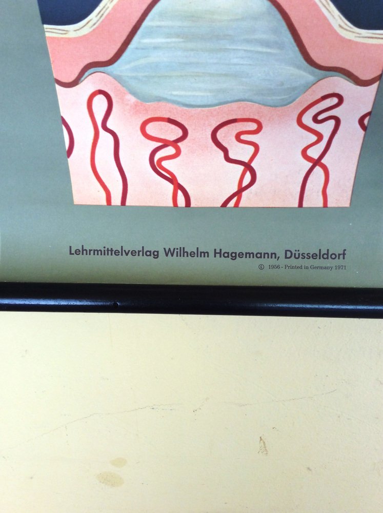 Pull-Down Anatomical Wall Chart by Hagemann, Düsseldorf, 1970s for sale ...