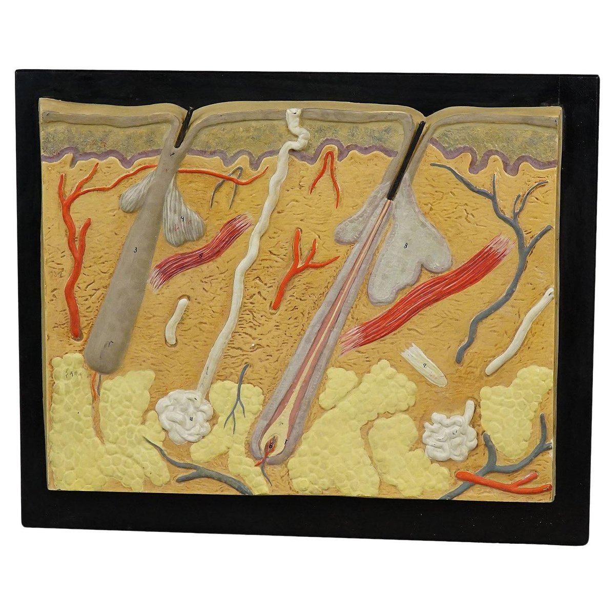 Teaching Aid-Structure of the Human Skin Plaster on Wood, 1920s for ...