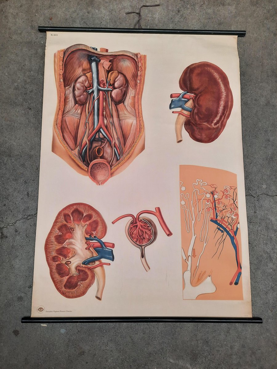 Eastern German Educational Poster of the Human Kidney in Linen, 1988 ...