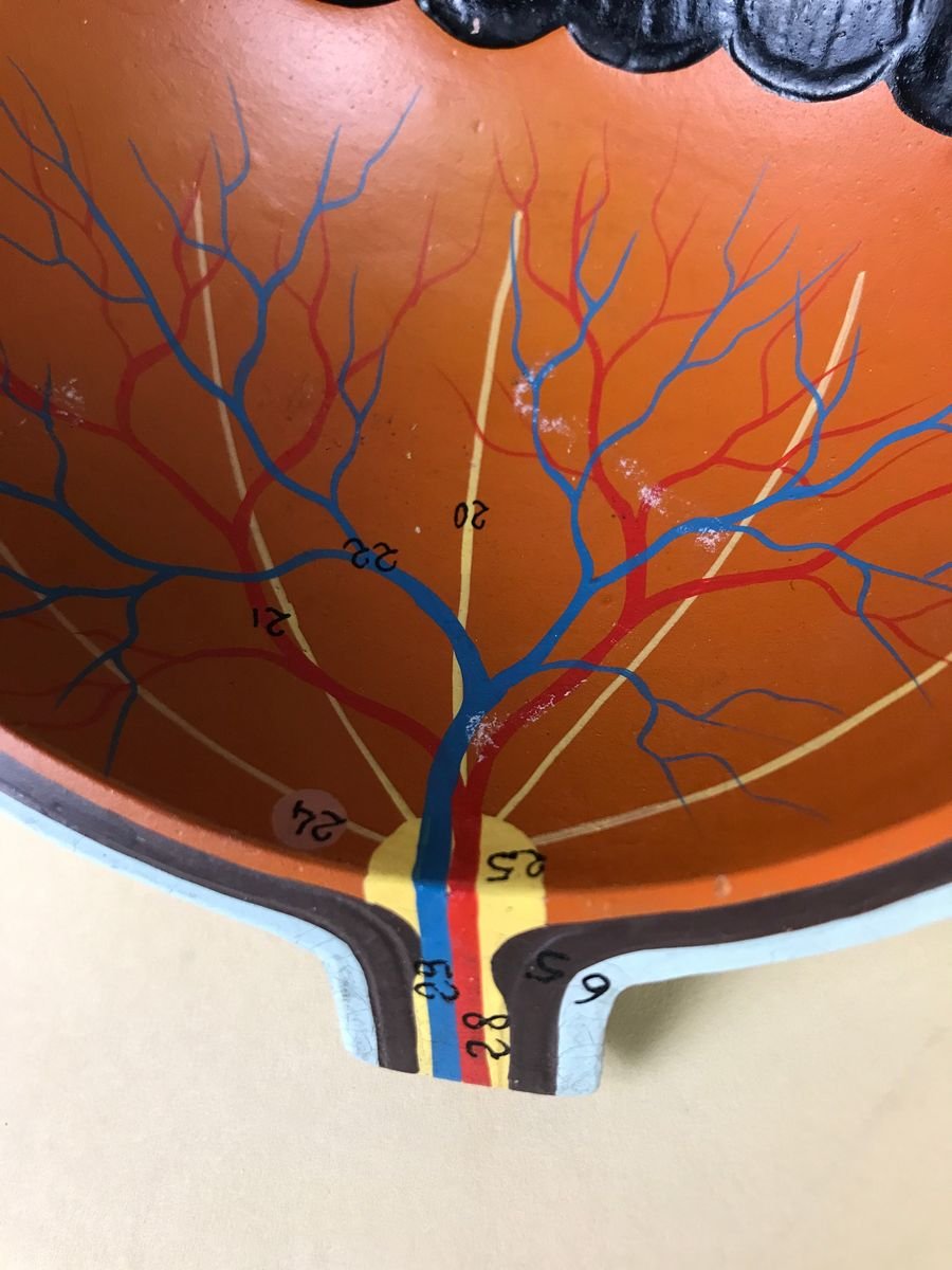 Vintage Italian Anatomical Human Left Eye Model in Plastic from Paravia ...